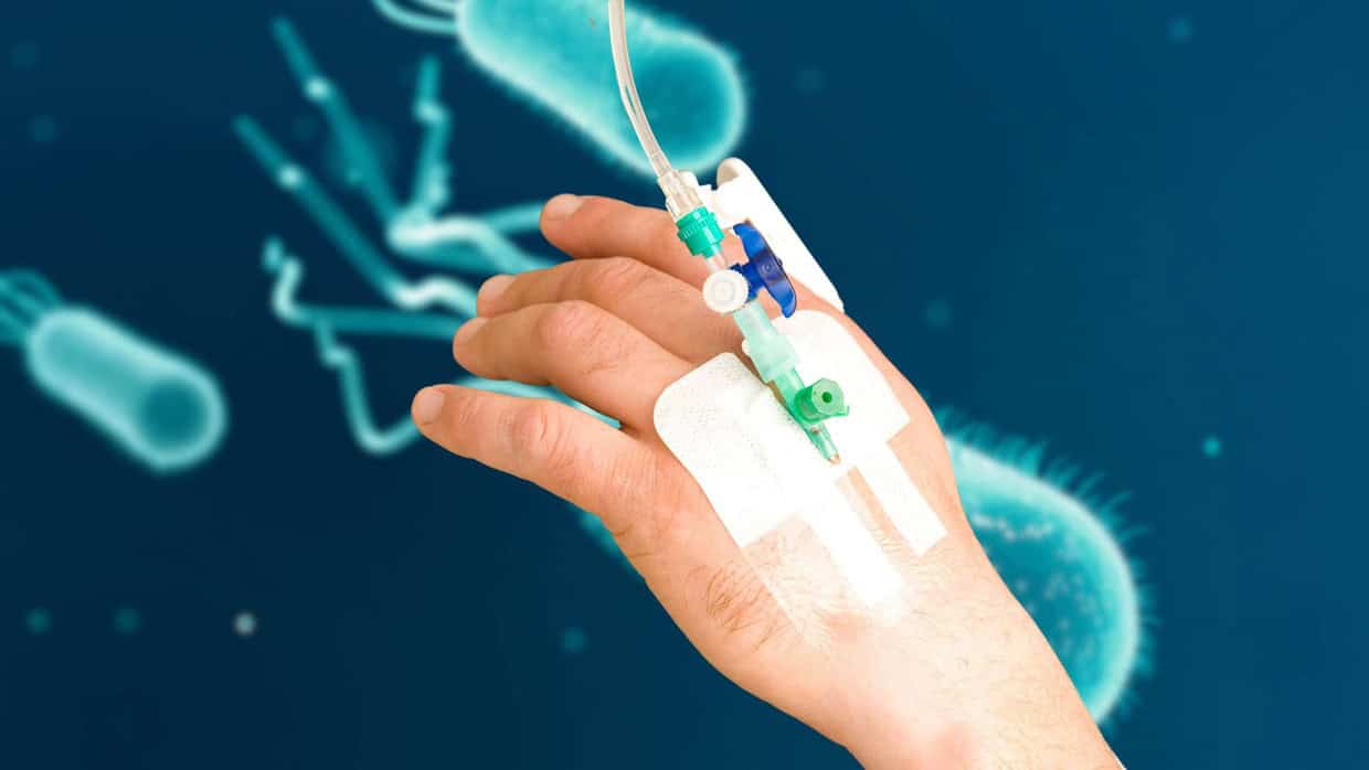 Catheter-associated UTI (CAUTIs) | Common HAIs